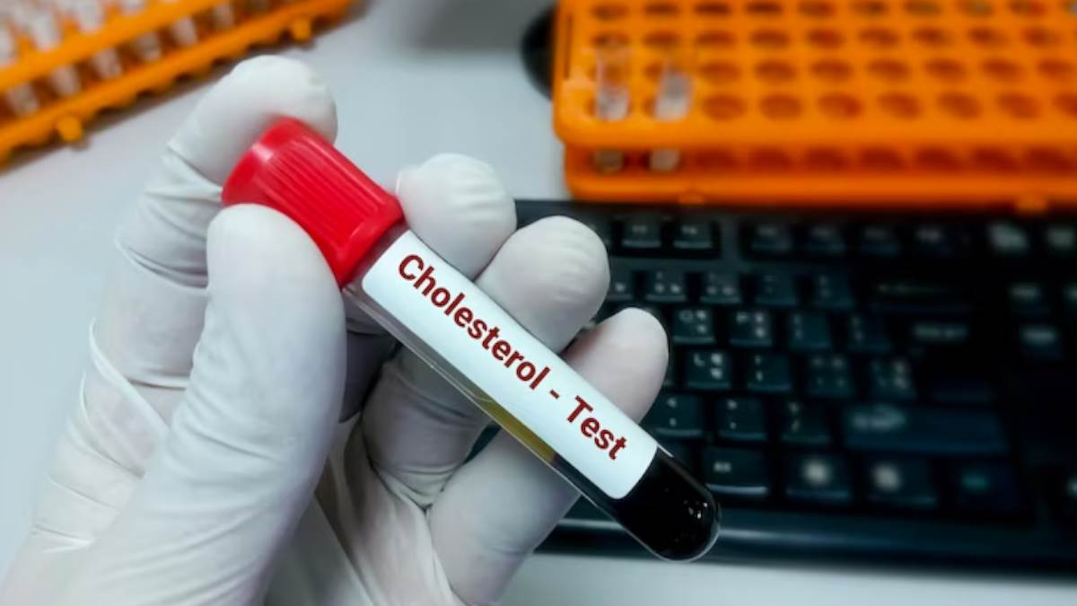 लिपिड प्रोफाइल टेस्ट Lipid Profile Test क्या है जानें कबसे टेस्ट